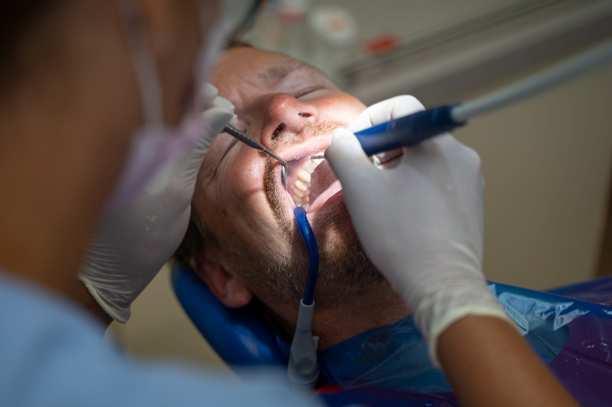 Parodontitis: Wie man erkennt und heilt? | Centrocc Dental
